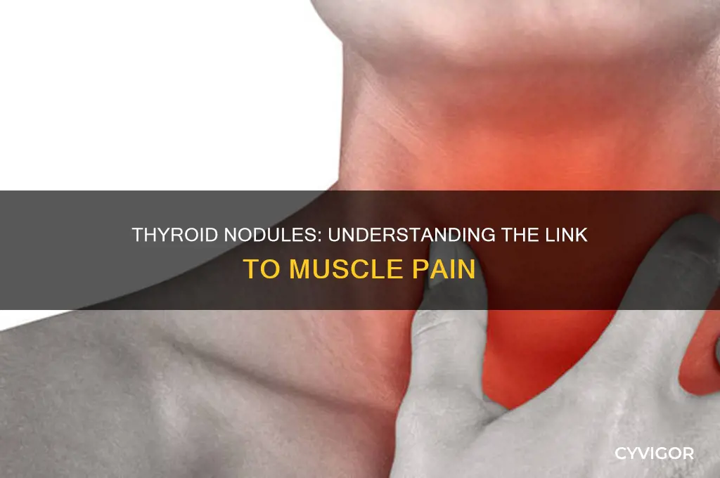 Thyroid Nodules: Understanding The Link To Muscle Pain | CyVigor