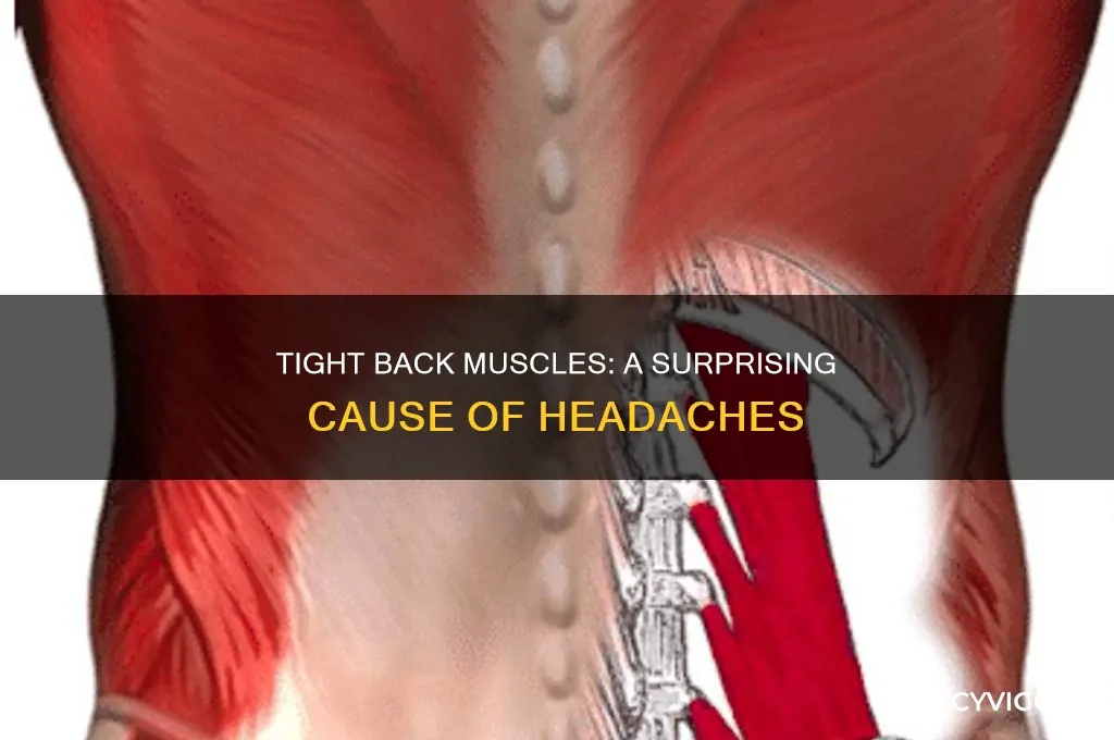 Tight Back Muscles: A Surprising Cause Of Headaches | CyVigor