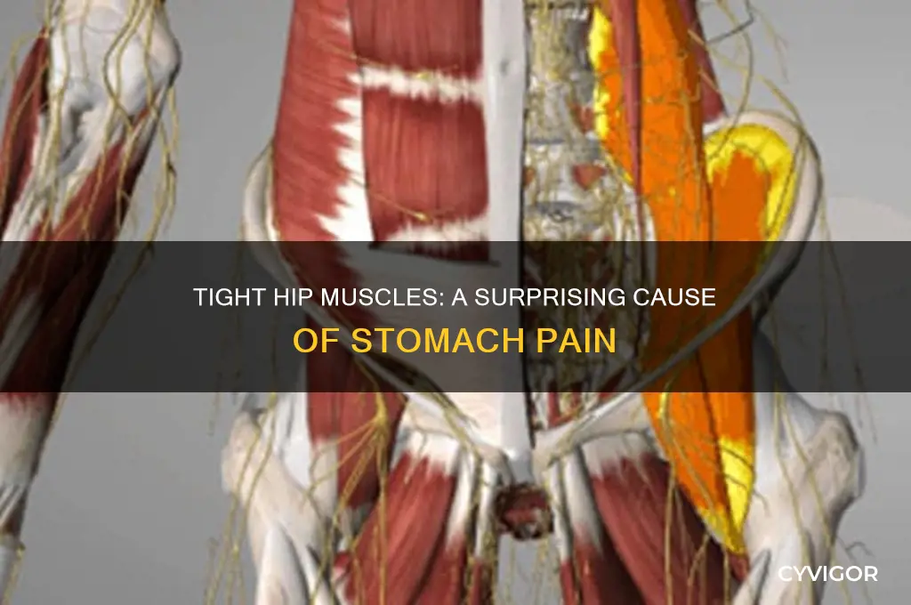 Tight Hip Muscles: A Surprising Cause Of Stomach Pain | CyVigor