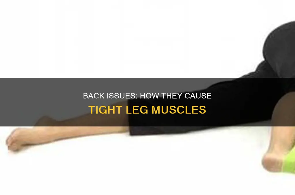 Back Issues: How They Cause Tight Leg Muscles | CyVigor