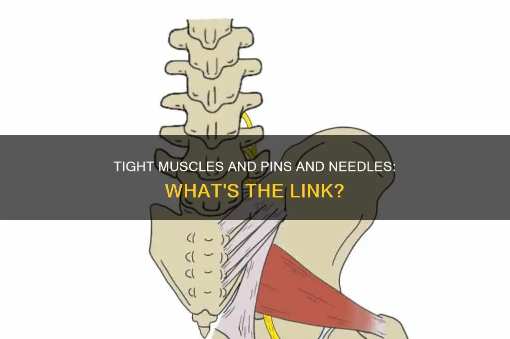 Tight Muscles And Pins And Needles: What's The Link? | CyVigor