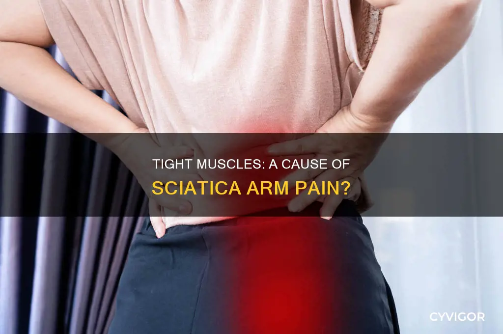 Tight Muscles: A Cause Of Sciatica Arm Pain? | CyVigor
