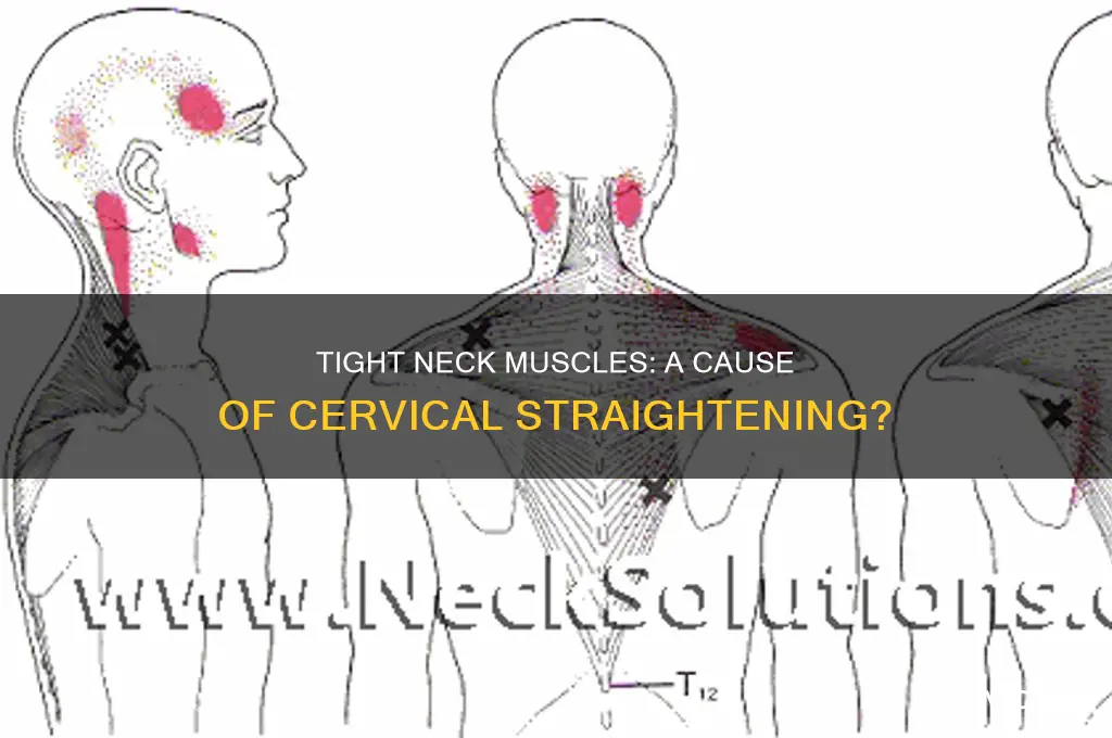 Tight Neck Muscles: A Cause Of Cervical Straightening? | CyVigor
