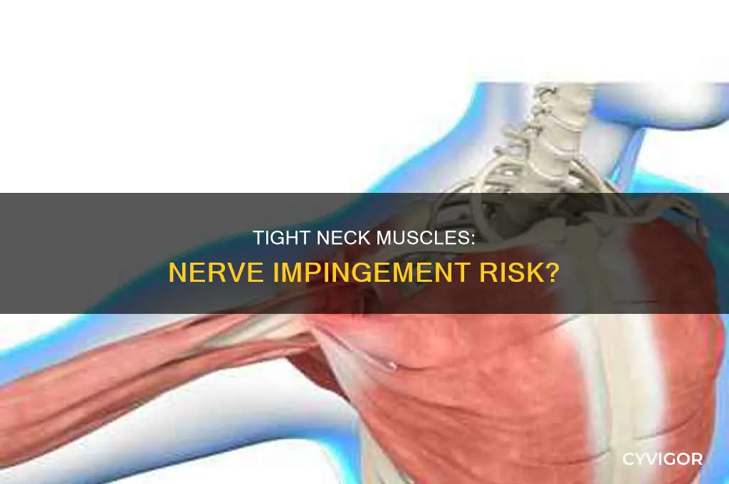 Tight Neck Muscles: Nerve Impingement Risk? | CyVigor
