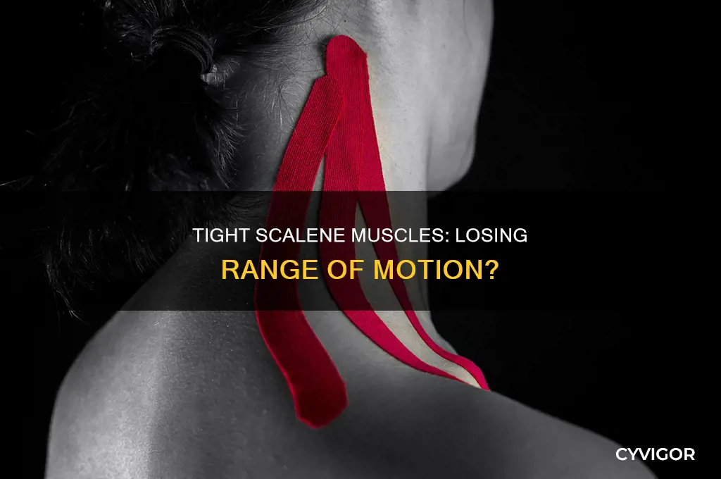 Tight Scalene Muscles: Losing Range Of Motion? | CyVigor