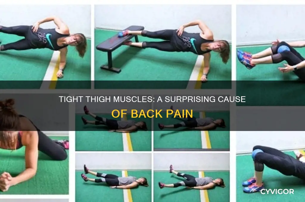 Tight Thigh Muscles: A Surprising Cause Of Back Pain | CyVigor