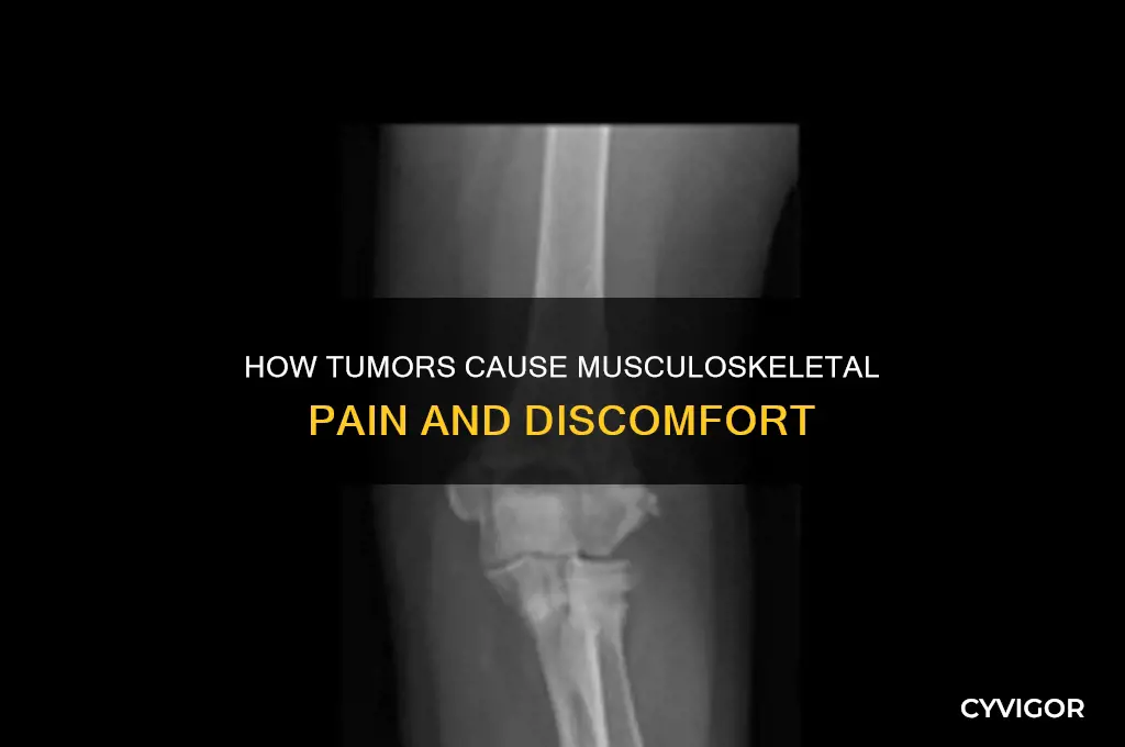 How Tumors Cause Musculoskeletal Pain And Discomfort | CyVigor