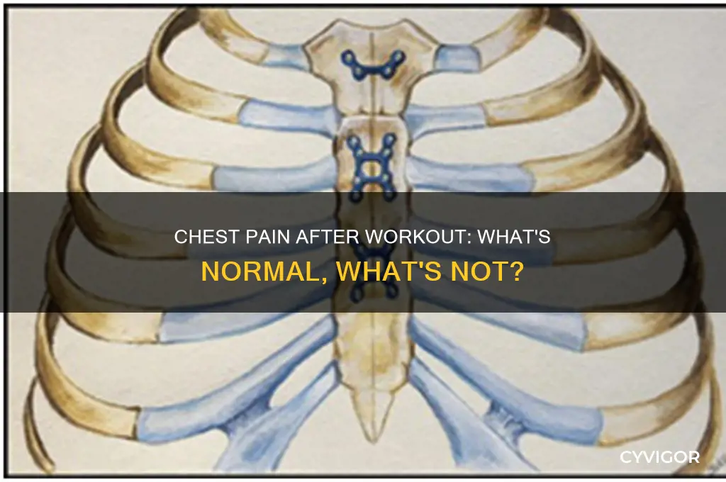Chest Pain After Workout: What's Normal, What's Not? | CyVigor