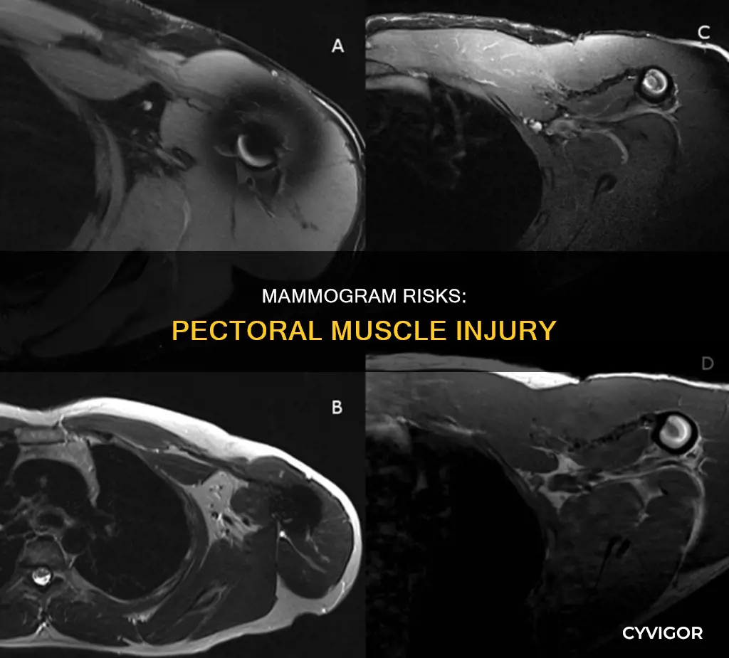 Mammogram Risks: Pectoral Muscle Injury | CyVigor