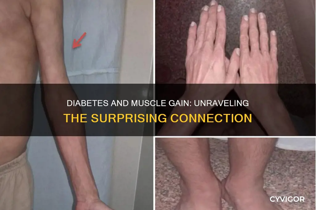 Diabetes And Muscle Gain: Unraveling The Surprising Connection | CyVigor