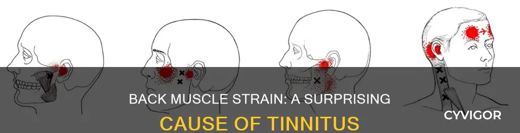 Back Muscle Strain: A Surprising Cause Of Tinnitus | CyVigor