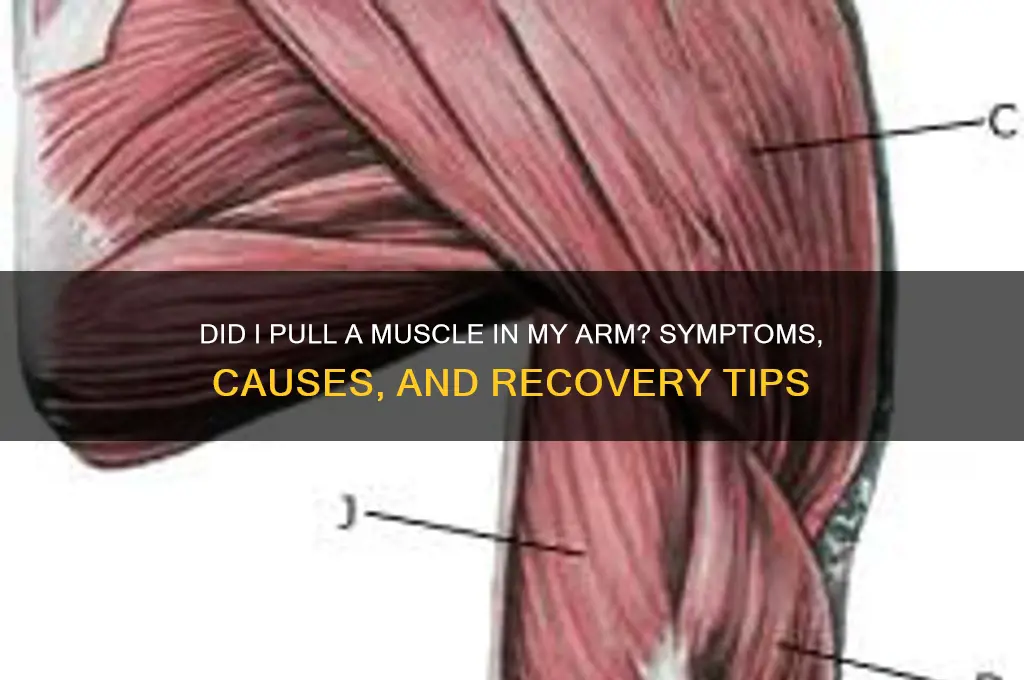 Did I Pull A Muscle In My Arm? Symptoms, Causes, And Recovery Tips ...