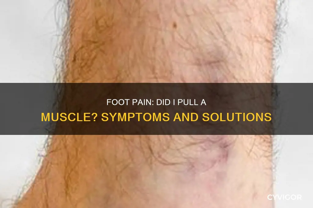 Foot Pain: Did I Pull A Muscle? Symptoms And Solutions | CyVigor