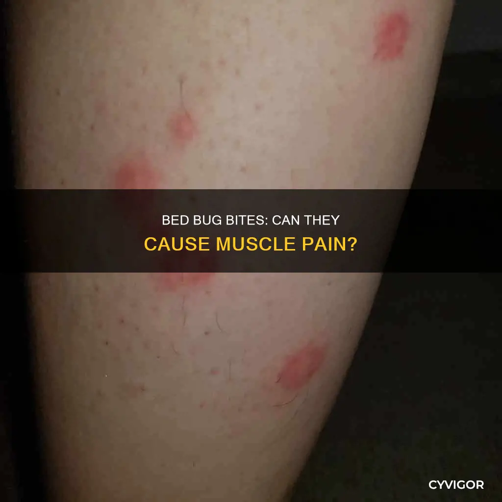 Bed Bug Bites: Can They Cause Muscle Pain? | CyVigor