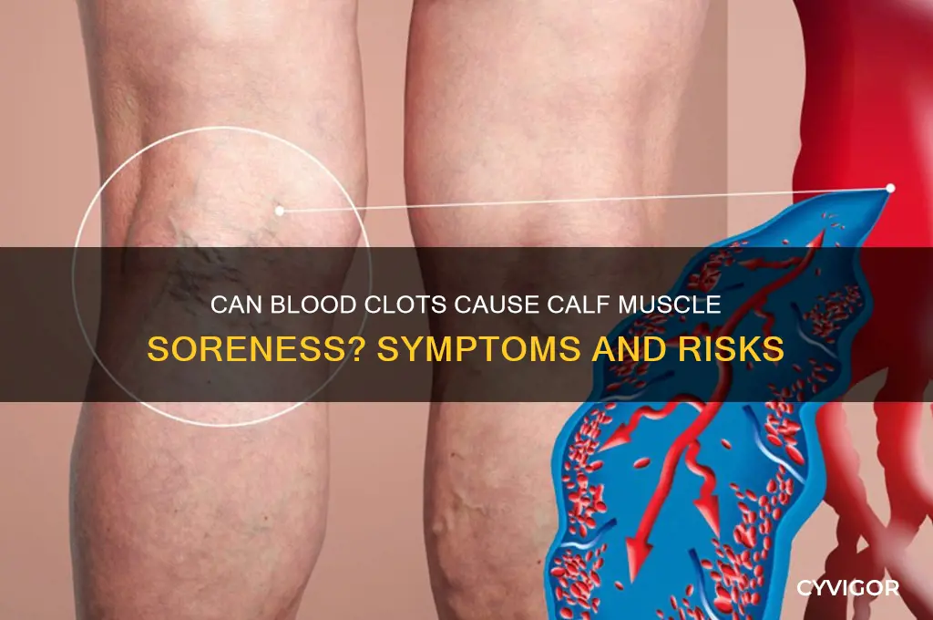 Can Blood Clots Cause Calf Muscle Soreness? Symptoms And Risks | CyVigor