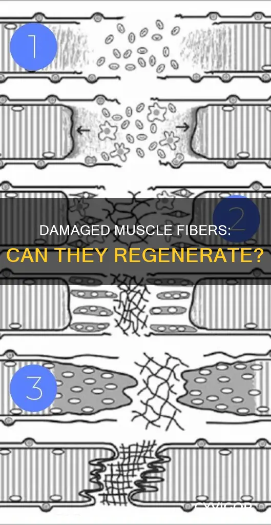 Damaged Muscle Fibers: Can They Regenerate? | CyVigor