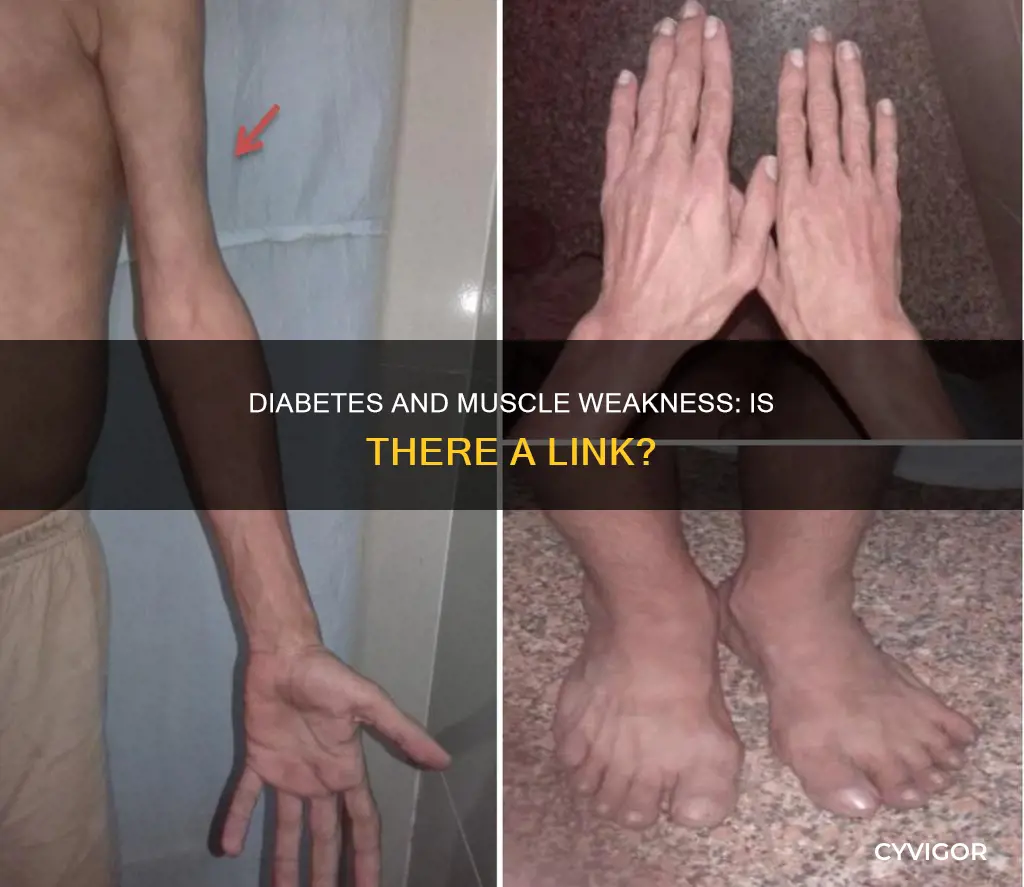 Diabetes And Muscle Weakness: Is There A Link? | CyVigor