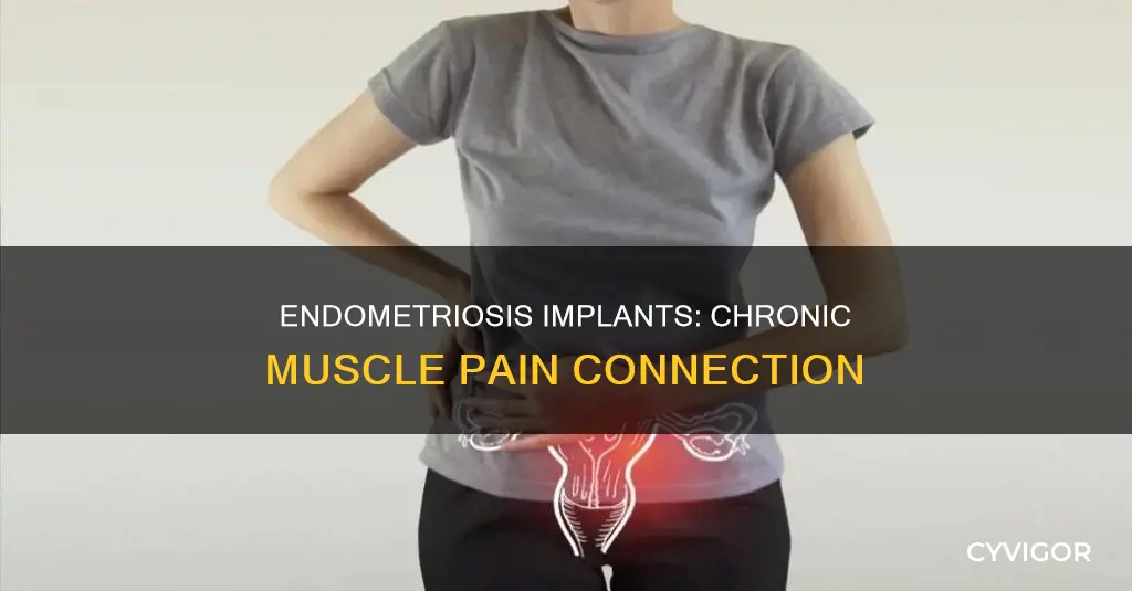 Endometriosis Implants: Chronic Muscle Pain Connection | CyVigor