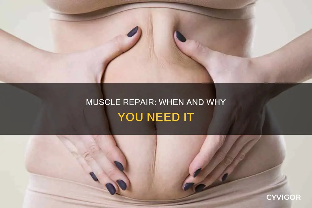 Muscle Repair: When And Why You Need It | CyVigor