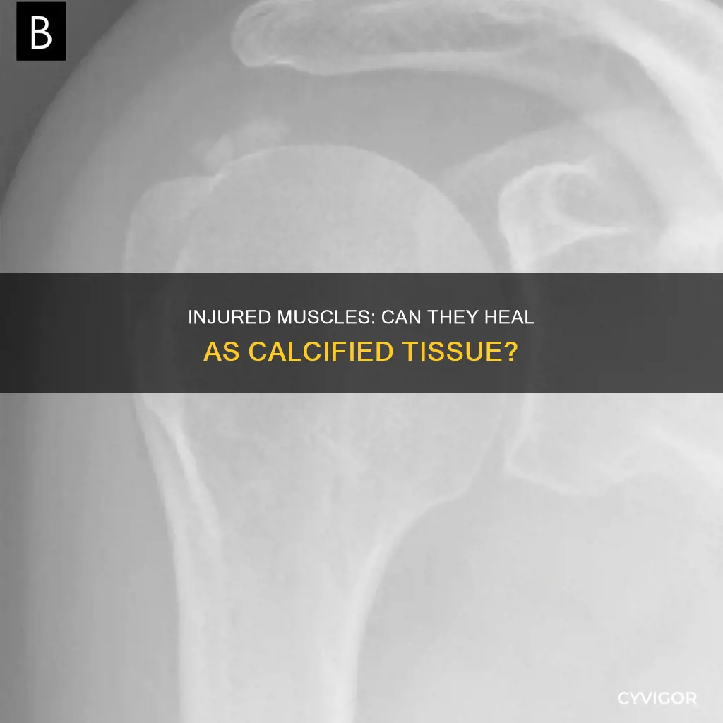 Injured Muscles: Can They Heal As Calcified Tissue? | CyVigor