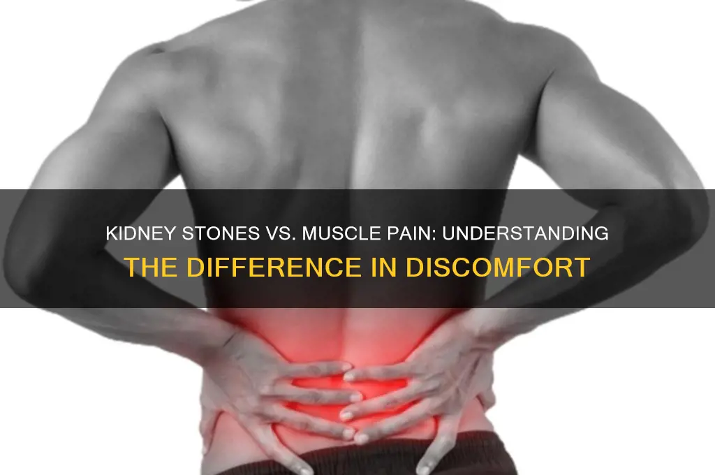 Kidney Stones Vs. Muscle Pain: Understanding The Difference In ...