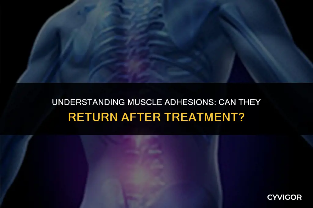 Understanding Muscle Adhesions: Can They Return After Treatment? | CyVigor