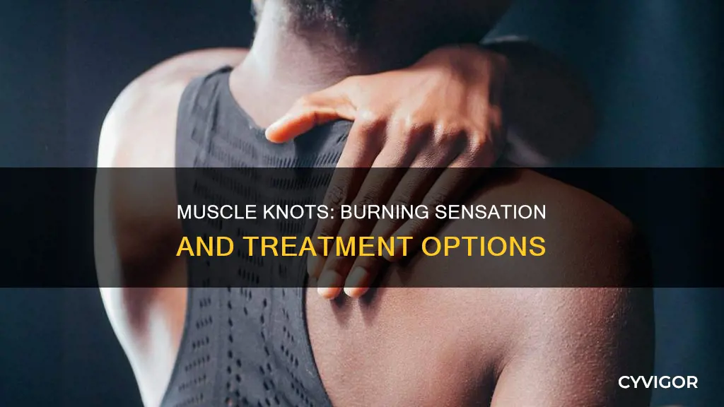 Muscle Knots: Burning Sensation And Treatment Options | CyVigor