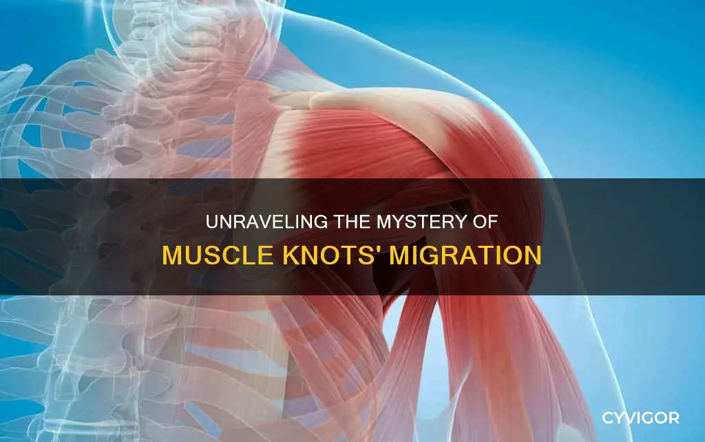 Unraveling The Mystery Of Muscle Knots' Migration | CyVigor