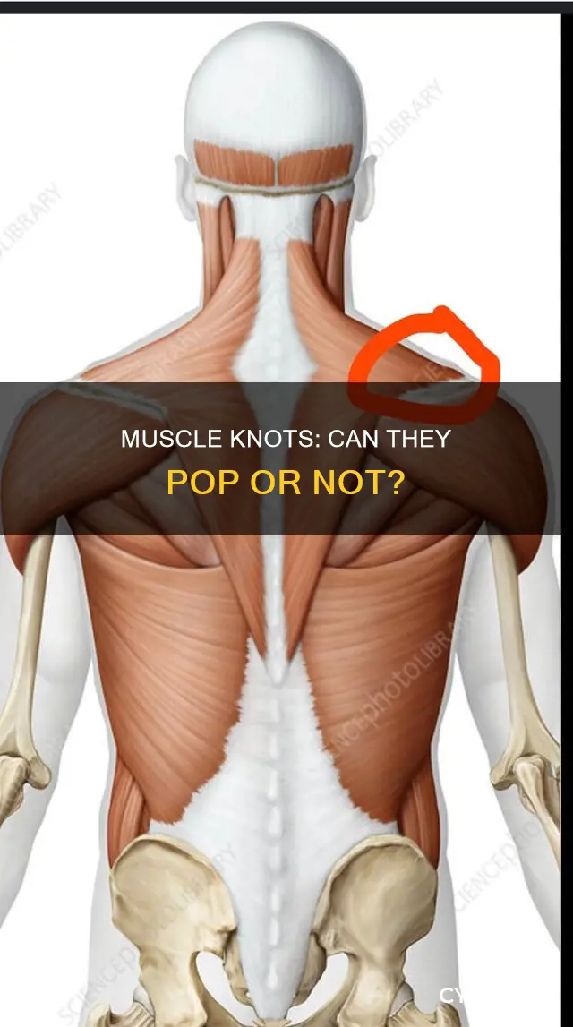 Muscle Knots: Can They Pop Or Not? | CyVigor