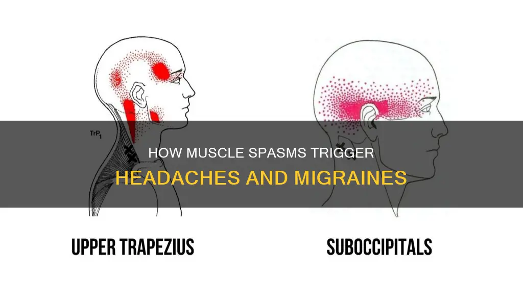 How Muscle Spasms Trigger Headaches And Migraines | CyVigor
