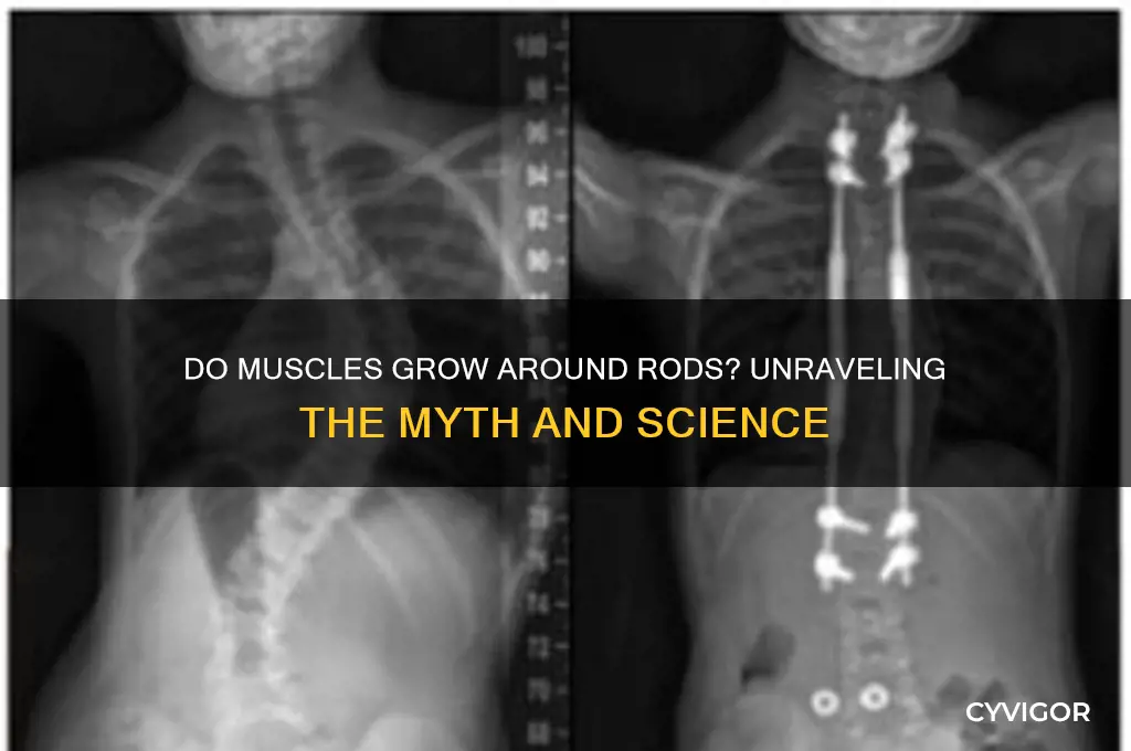 Do Muscles Grow Around Rods? Unraveling The Myth And Science | CyVigor