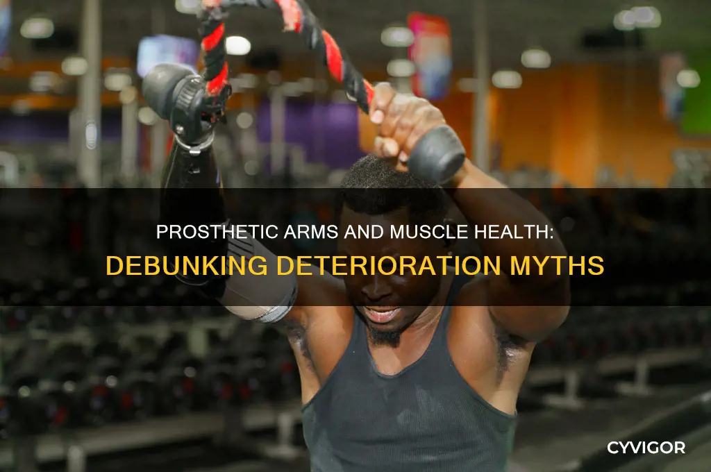 Prosthetic Arms And Muscle Health: Debunking Deterioration Myths | CyVigor