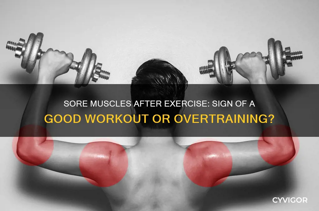 Sore Muscles After Exercise: Sign Of A Good Workout Or Overtraining ...
