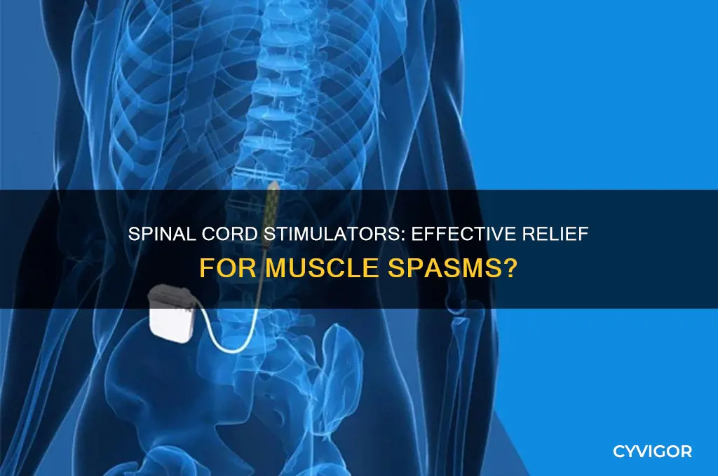 Spinal Cord Stimulators: Effective Relief For Muscle Spasms? | CyVigor