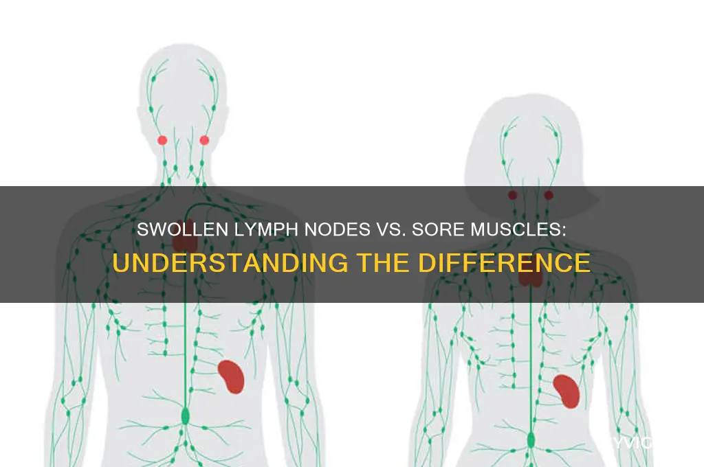 Swollen Lymph Nodes Vs. Sore Muscles: Understanding The Difference ...