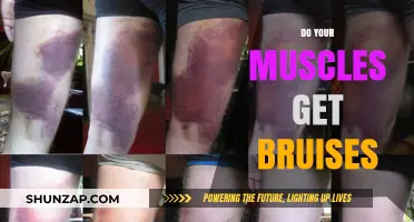 Understanding The Science Behind Muscle And Joint Popping Sounds | CyVigor