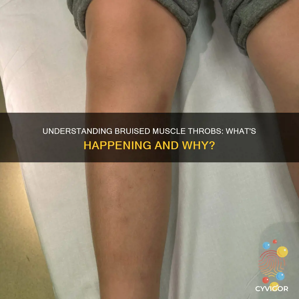 Understanding Bruised Muscle Throbs: What's Happening And Why? | CyVigor
