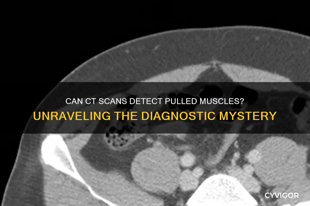 Can Ct Scans Detect Pulled Muscles? Unraveling The Diagnostic Mystery ...