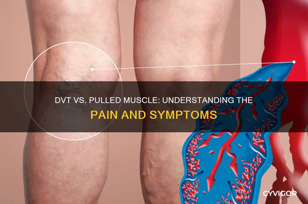 Dvt Vs. Pulled Muscle: Understanding The Pain And Symptoms | CyVigor