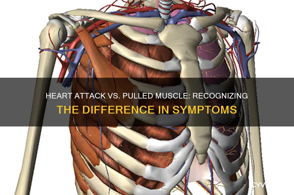 Heart Attack Vs. Pulled Muscle: Recognizing The Difference In Symptoms ...