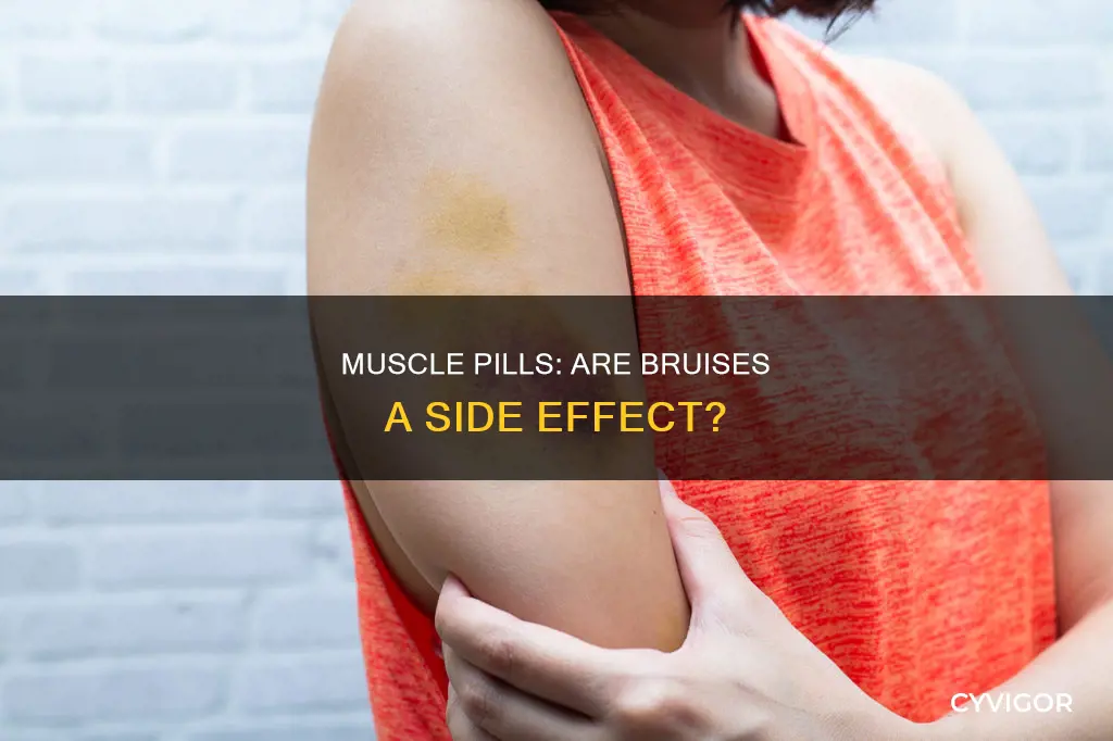 Muscle Pills: Are Bruises A Side Effect? | CyVigor