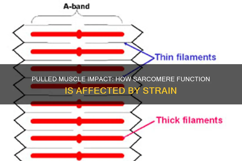 Pulled Muscle Impact: How Sarcomere Function Is Affected By Strain ...