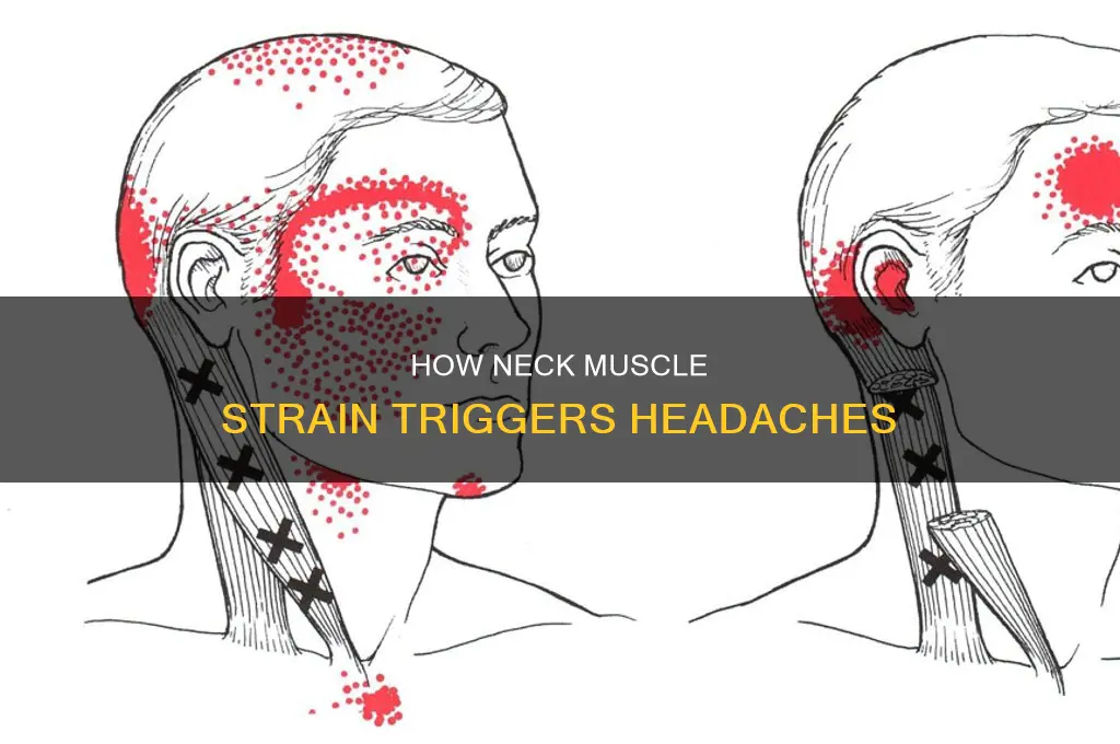How Neck Muscle Strain Triggers Headaches | CyVigor