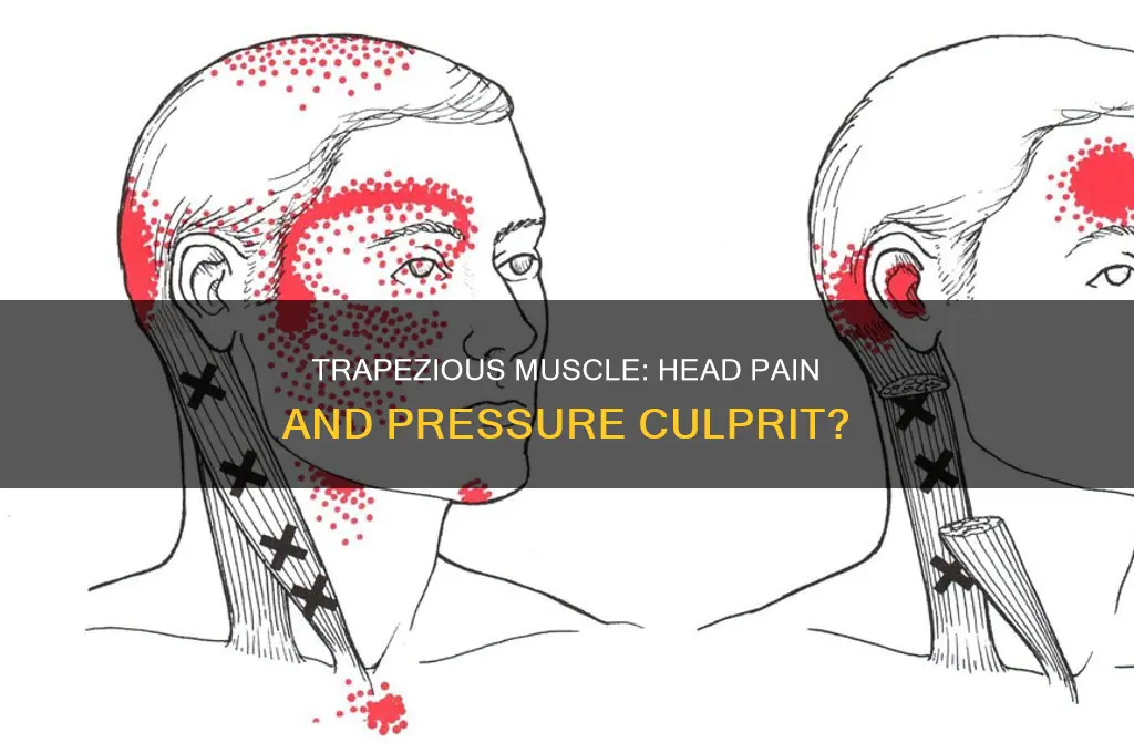 Trapezious Muscle: Head Pain And Pressure Culprit? | CyVigor
