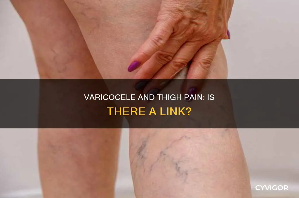 Varicocele And Thigh Pain: Is There A Link? | CyVigor