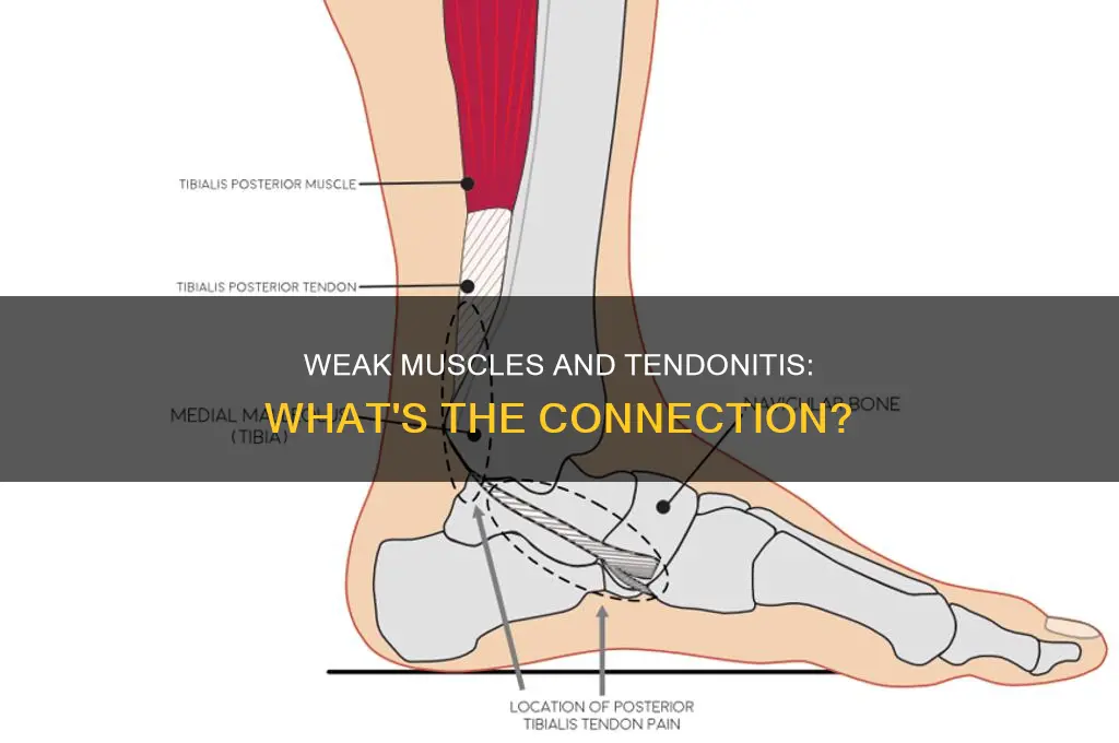 Weak Muscles And Tendonitis: What's The Connection? | CyVigor