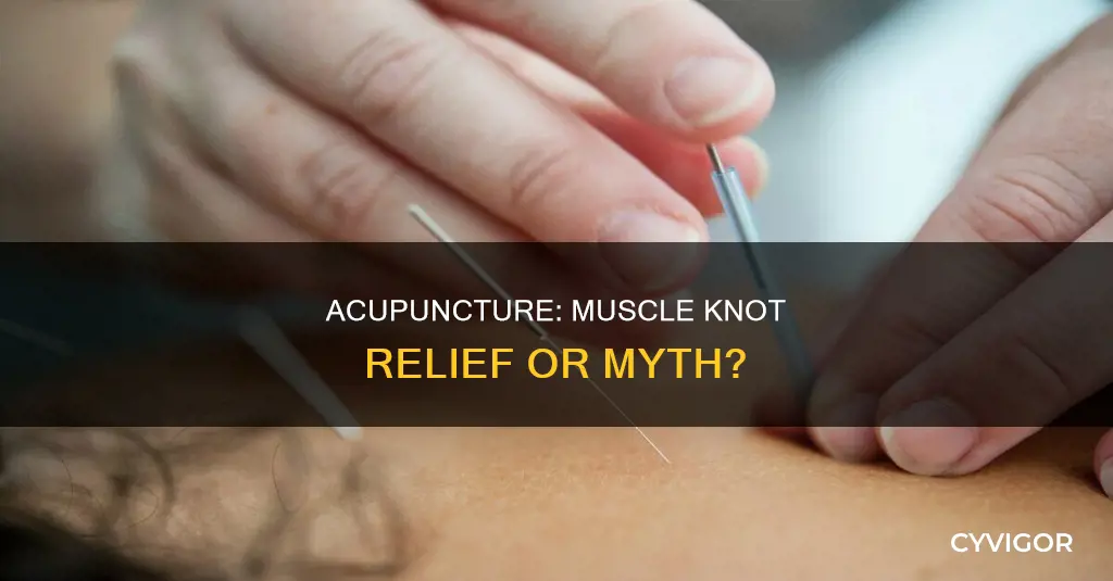 Acupuncture: Muscle Knot Relief Or Myth? | CyVigor