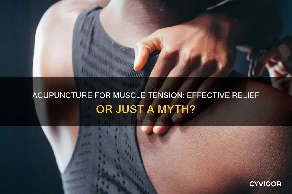 Acupuncture For Muscle Tension: Effective Relief Or Just A Myth? | CyVigor