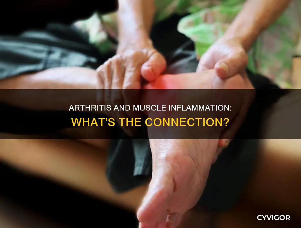 Arthritis And Muscle Inflammation: What's The Connection? | CyVigor