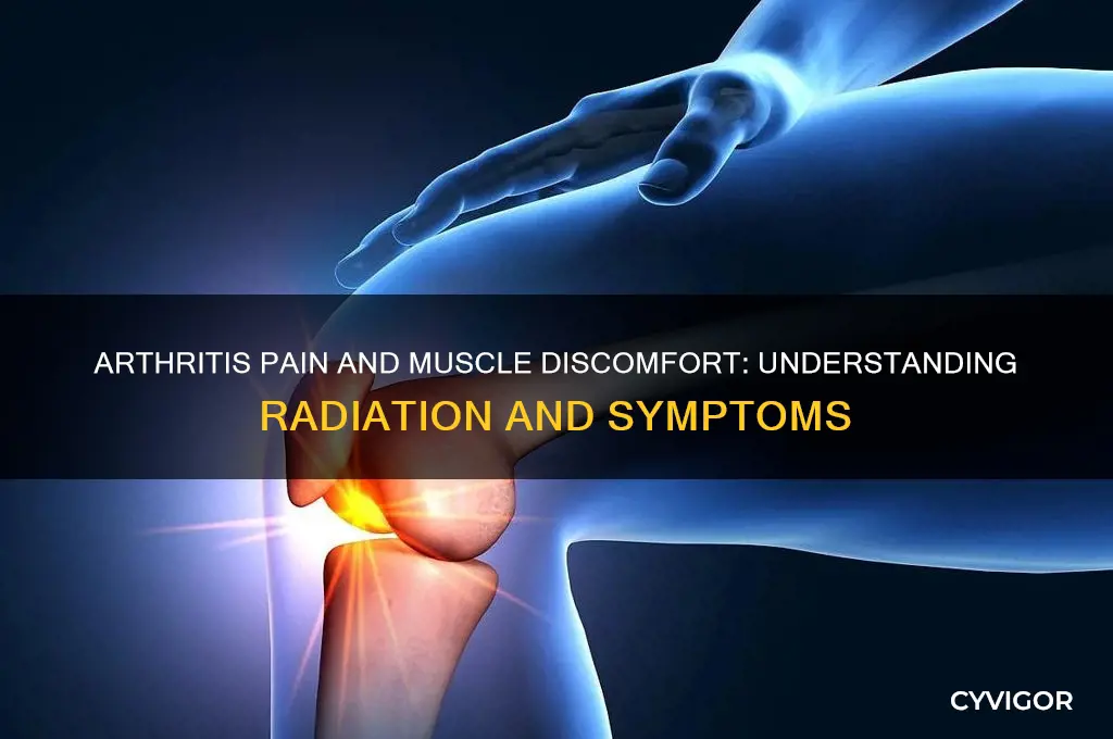 Arthritis Pain And Muscle Discomfort: Understanding Radiation And ...